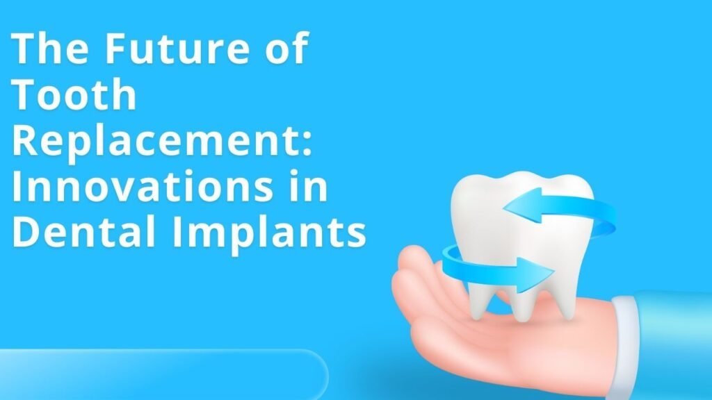 The Future of Tooth Replacement: Innovations in Dental Implants - Cool ...